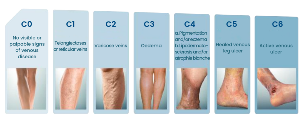 About CVI | Basis Medical